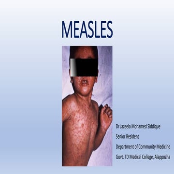 MEASLES.pptx