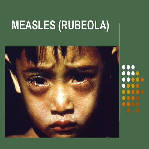 Measles | PPTX