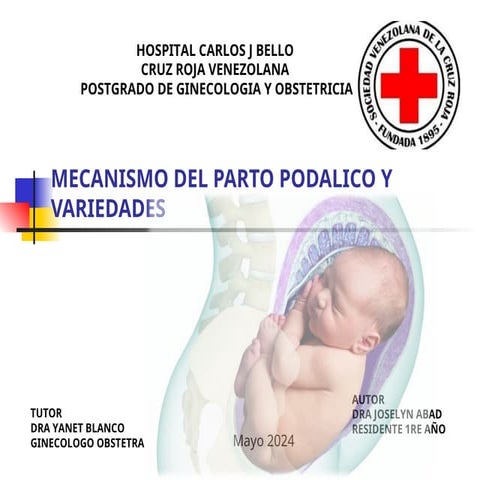 MECANISMO DEL PARTO PODALICO Y VARIEDADES JOSELYN ABAD.ppt