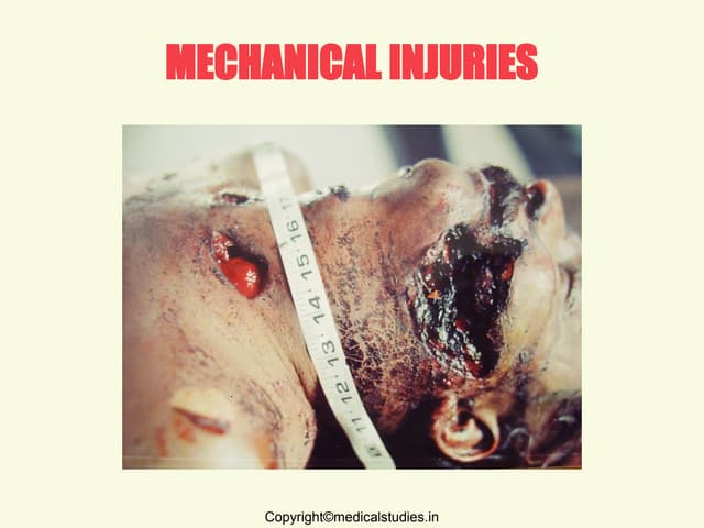 MECHANICAL INJURIES | DOCX