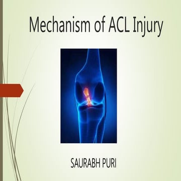 Mechanism of ACL InjURY | PPTX
