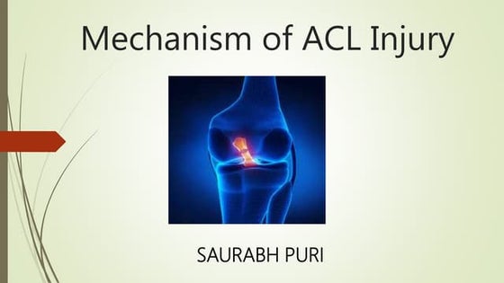 Causes and Risk Factors for ACL Injury | PPTX