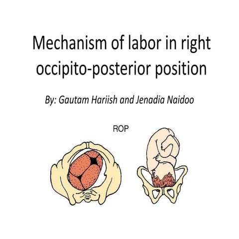 Mechanism of labor in right occipito posterior position | PPTX
