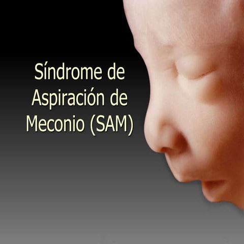 Meconio | PPTX