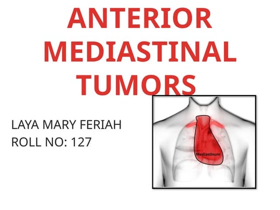 MRI IAM.ppt abcdefghijklmnopqrstuvwxyz123 | PPT