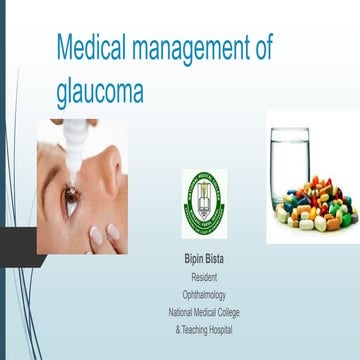 Medical management of glaucoma | PPTX