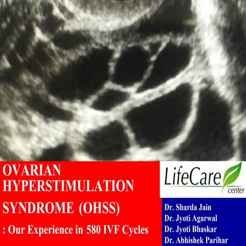 Medical managment of ovarian hyperstimulation | PPT