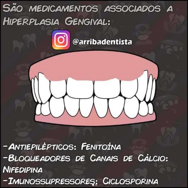 Arco Tipo I e Tipo II de Baume - Resumo Concurso Público de Odontologia.pdf