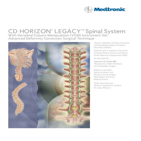 Medtronic cd horizonadvanceddeformityst | PDF