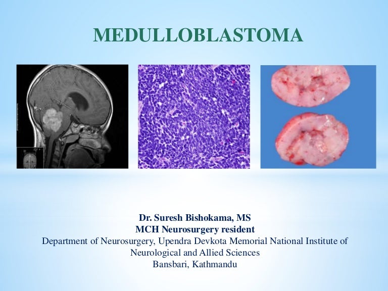 MEDULLOBLASTOMA