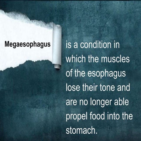 Mega e | PPTX | Digestive Disorders | Diseases and Conditions