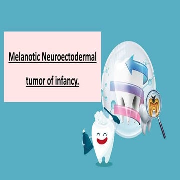 Melanotic Neuroectodermal Tumor Of Infancy Pptx