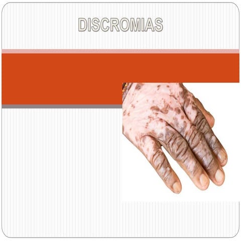 Discromías | PPTX