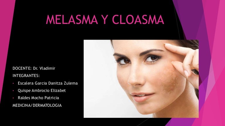 Melasma y cloasma expo