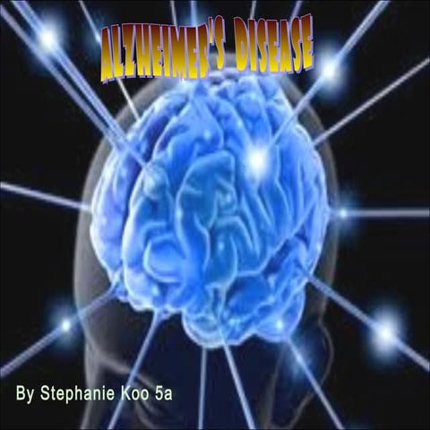 Memory loss | PPT