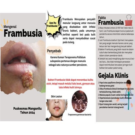 Mengenal Frambusia dan gejala yang ditimbulkan | PDF