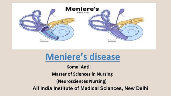 Meniere’s Disease.ppt