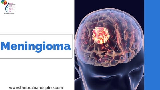 Meningioma: Understanding Symptoms, Diagnosis, and Treatment Options ...
