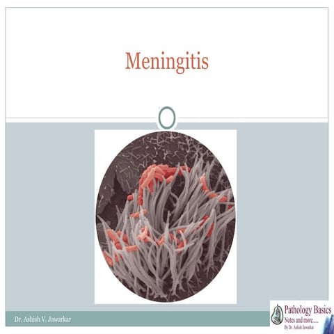 Meningitis | PPT | Infectious Diseases | Diseases and Conditions