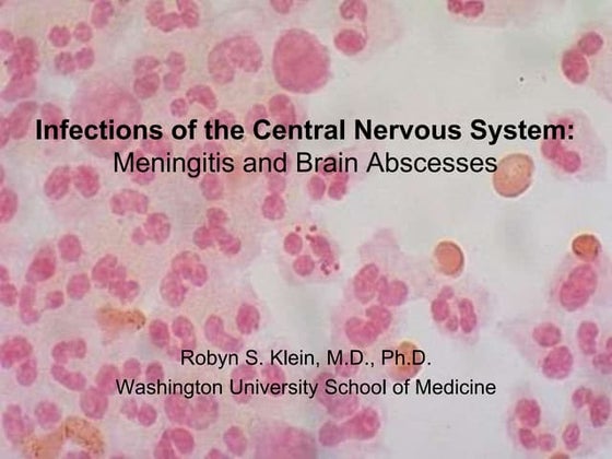 Chronic And Recurrent Meningitis Ppt