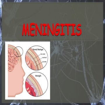 Meningitis | PPTX