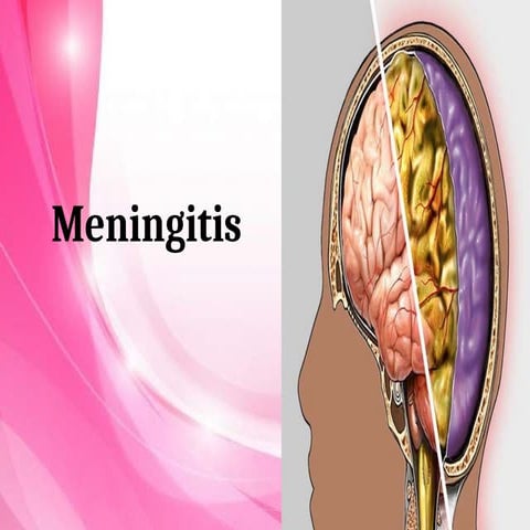 Comprehensive Overview of Meningitis: Causes, Symptoms, and Nursing ...