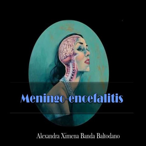 Meningo encefalitis | PPTX