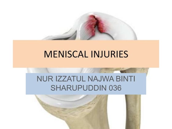 Meniscus: Structure, Role & Injury. | PPT