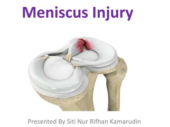Injuries to ACL, PCL, and MCL | PPT