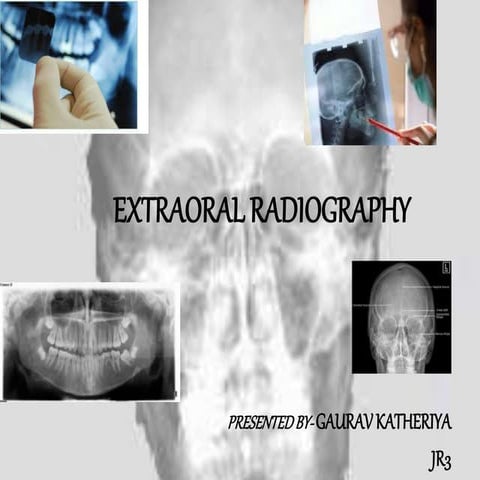 landmarks and interpretation in extraoral radiography | PPTX