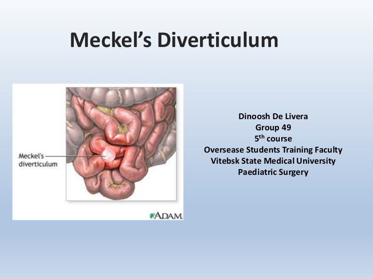 Merkel's diverticulum