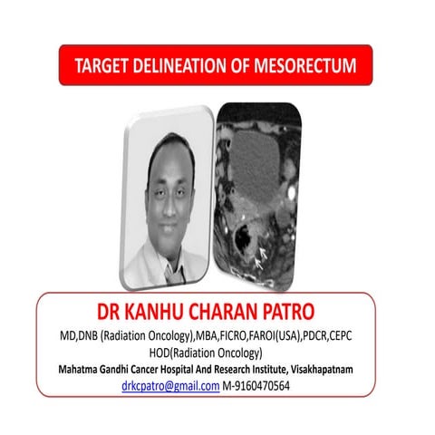 MESORECTUM TARGET DELINEATION | PPTX