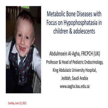 Metabolic bone disease with focus on hypophosphatasia | PDF | Bone and ...