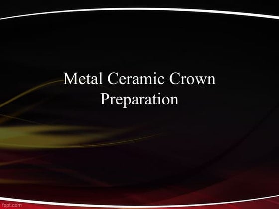 Different gingival finish lines (margins) of crowns and bridges | PPT