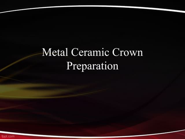 Different gingival finish lines (margins) of crowns and bridges | PPTX