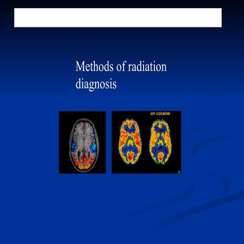 Methods for diagnosis for radiation presentation.ppt