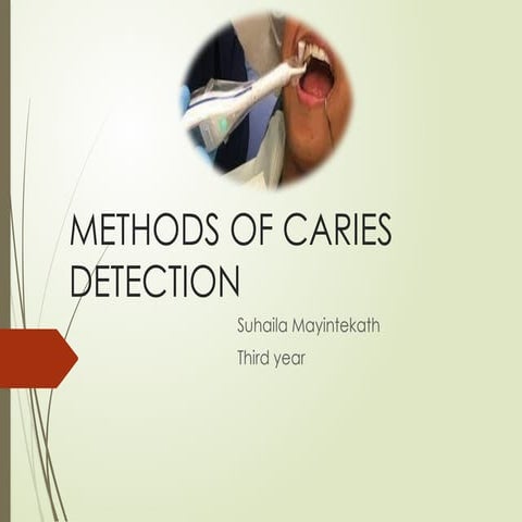METHODS OF CARIES DETECTION paedodontics | PPTX