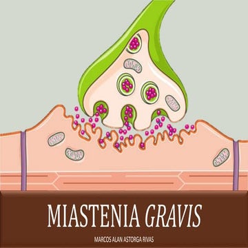 Miastenia gravis | PPTX