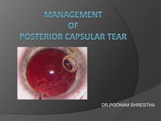 Complications of cataract surgery - nucleus drop | PPTX