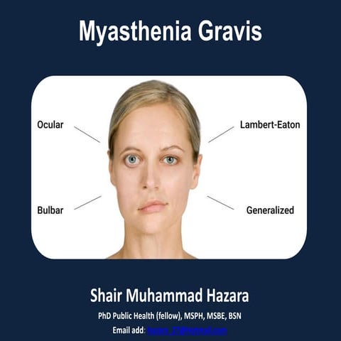 MG ppt lectur and its cause and treatment | PPT