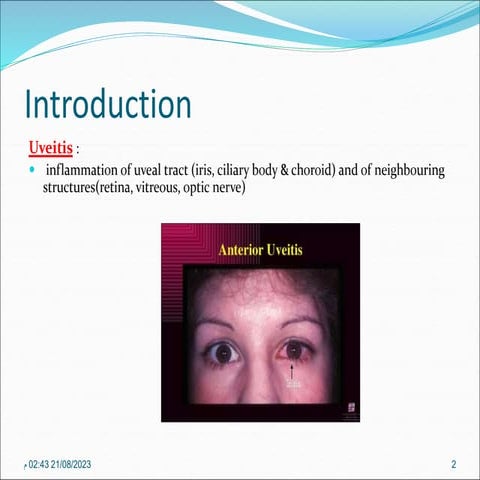 lecture_on_anterior_uveitis_new.ppt