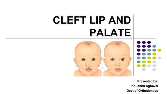 Oral Health for Children with Orofacial Clefts FDI GUIDELINES.pptx