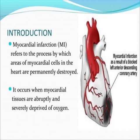 pharmacotherapeutics of myocardial-infarction | PPT