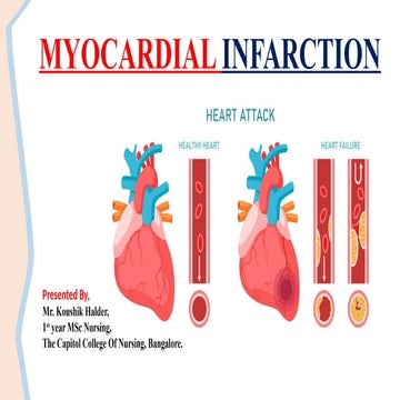 Myocardial Infarction: Easy-to-Understand Notes for Nursing Students.pptx