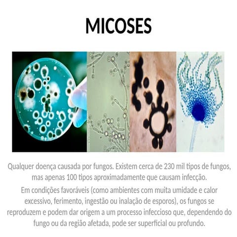 MICOSES humanas mais frequentes diagnostico | PPTX