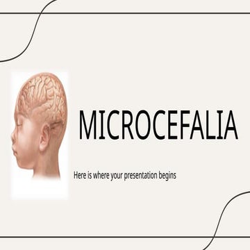 Microcefalia | PPTX