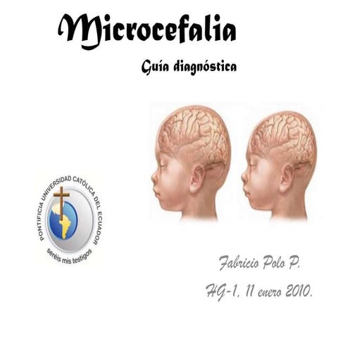 Microcefalia | PPTX