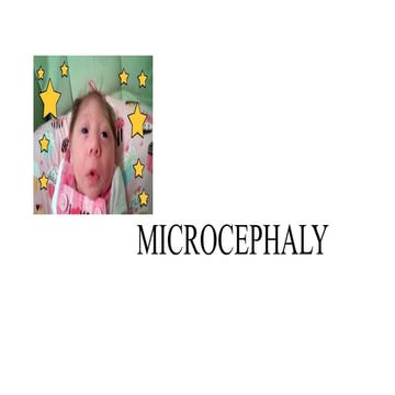 differentials of microcephaly in children population | PPTX