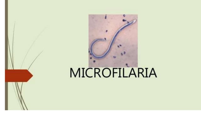 Wuchereria Bancrofti Slide