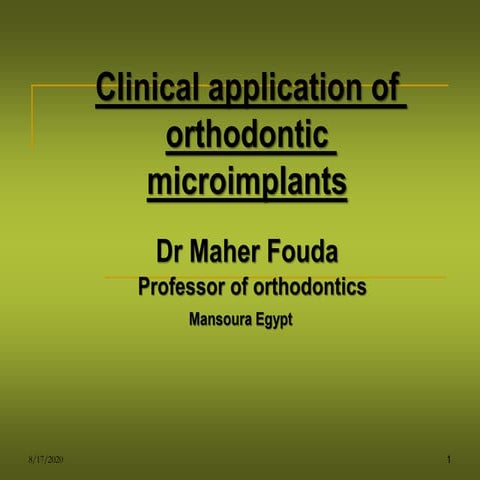 Infra-zygomatic Crest implants (IZC) | PPTX